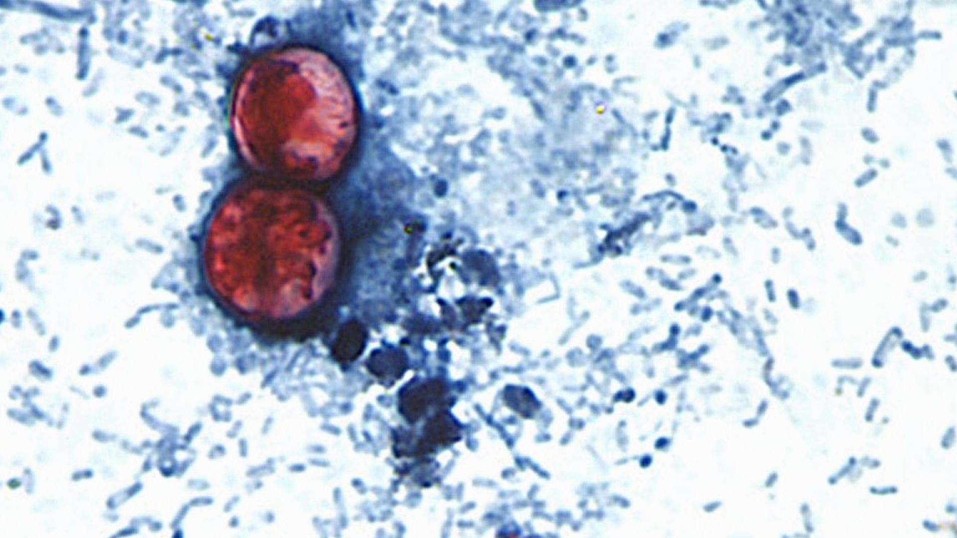 US officials tie cyclospora outbreak involving iceberg lettuce to 3 ...