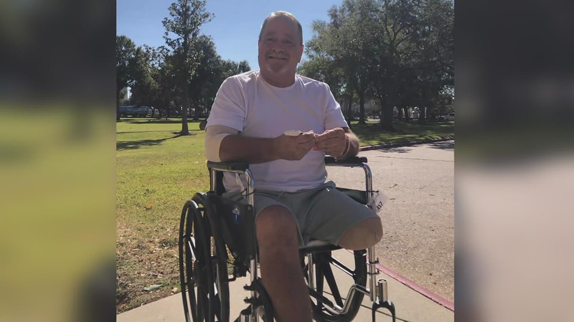 Man has leg amputated after contracting flesh-eating bacteria ...