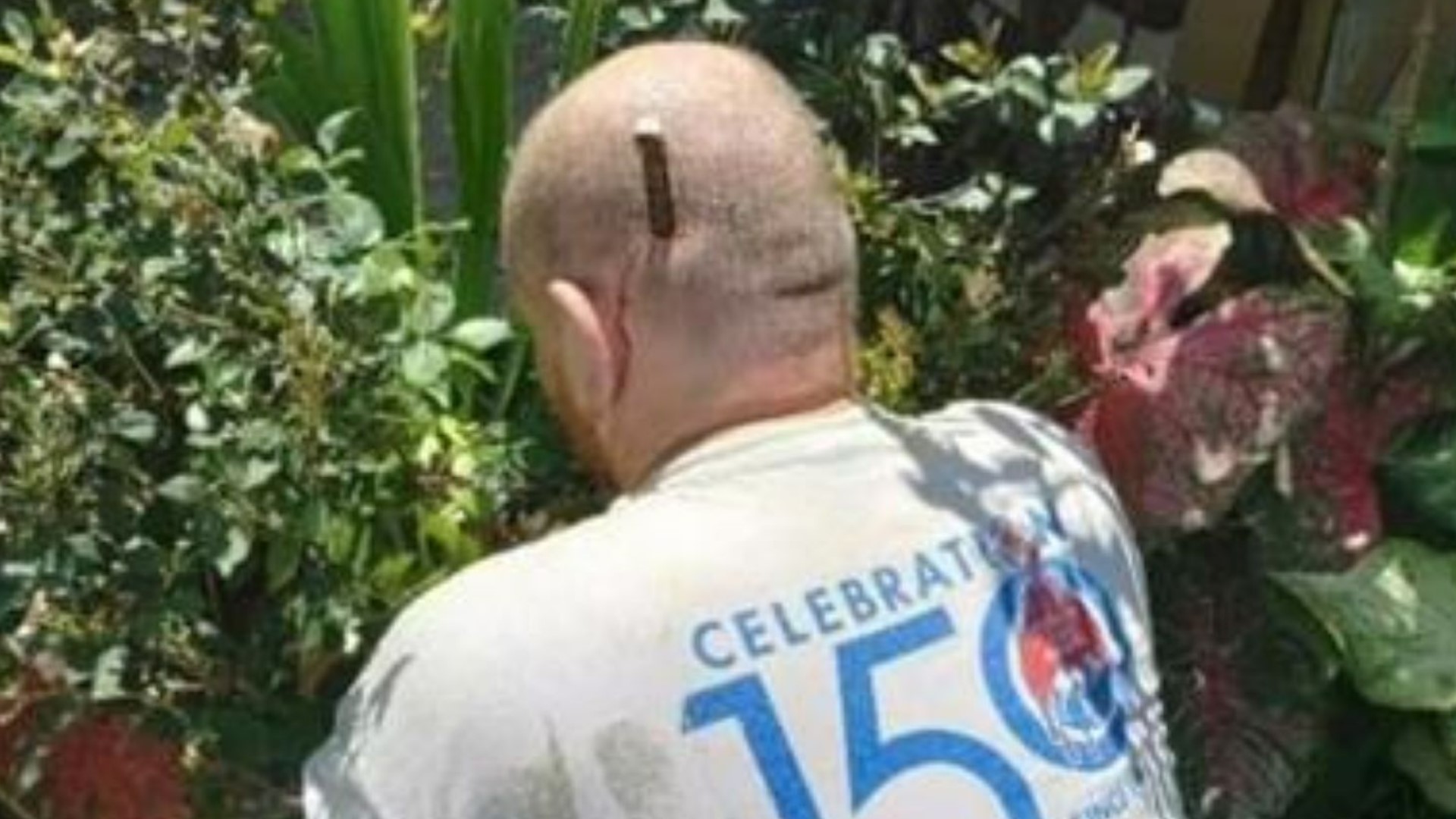 Fall leaves metal rod sticking through Nederland man's head | 12newsnow.com