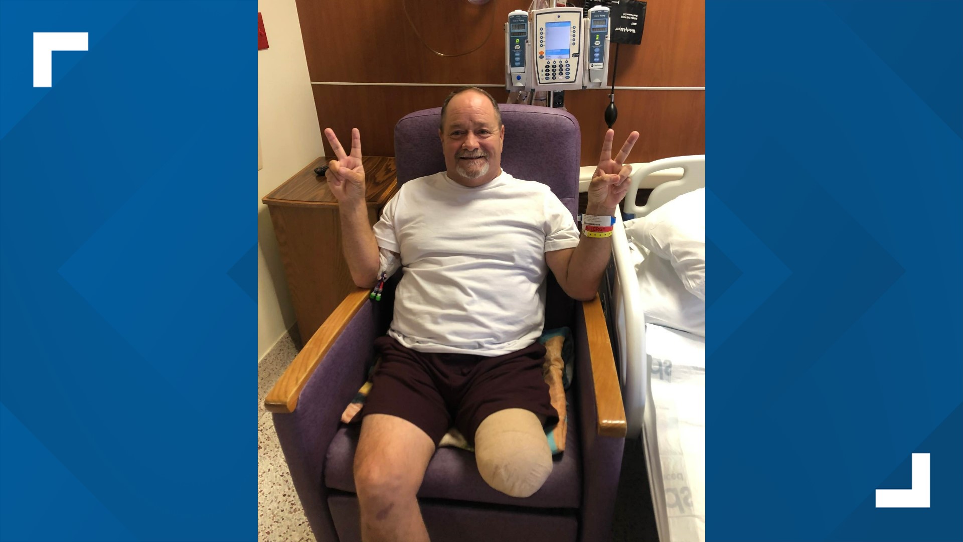 Amputee warns of flesh-eating bacteria ahead of warm weather ...